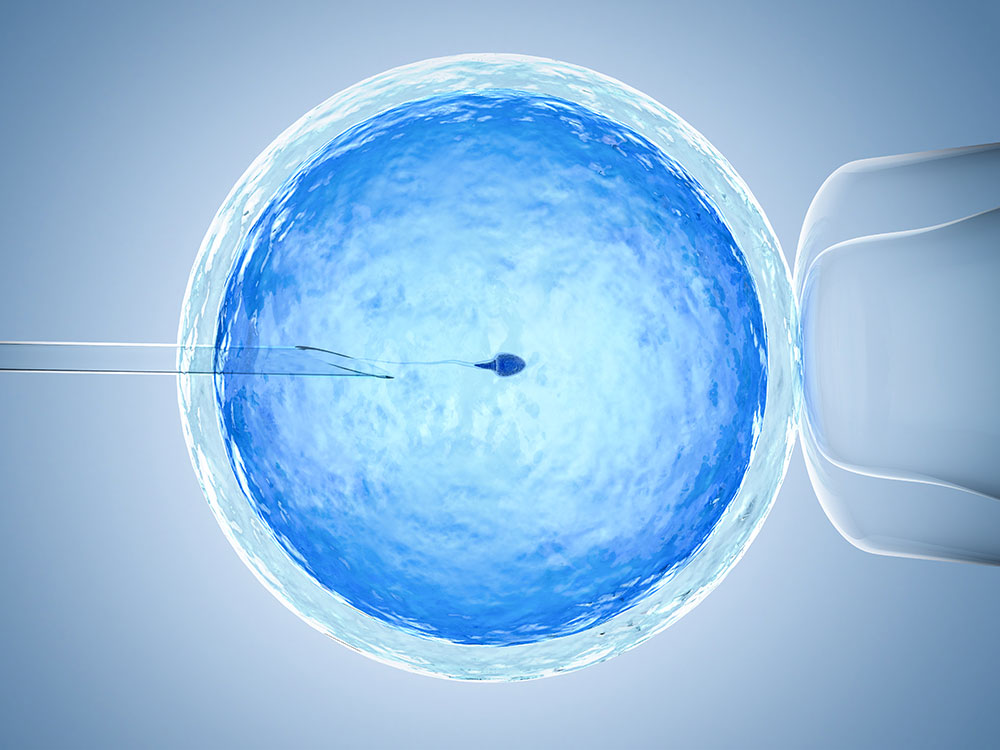 In Vitro Fertilisation (IVF) - Addam Donor Bank